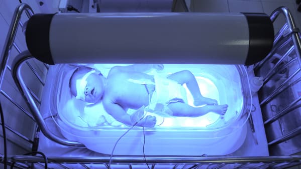 Firefly Newborn Phototherapy: Latest News, Work, Videos, Photos | Fast ...